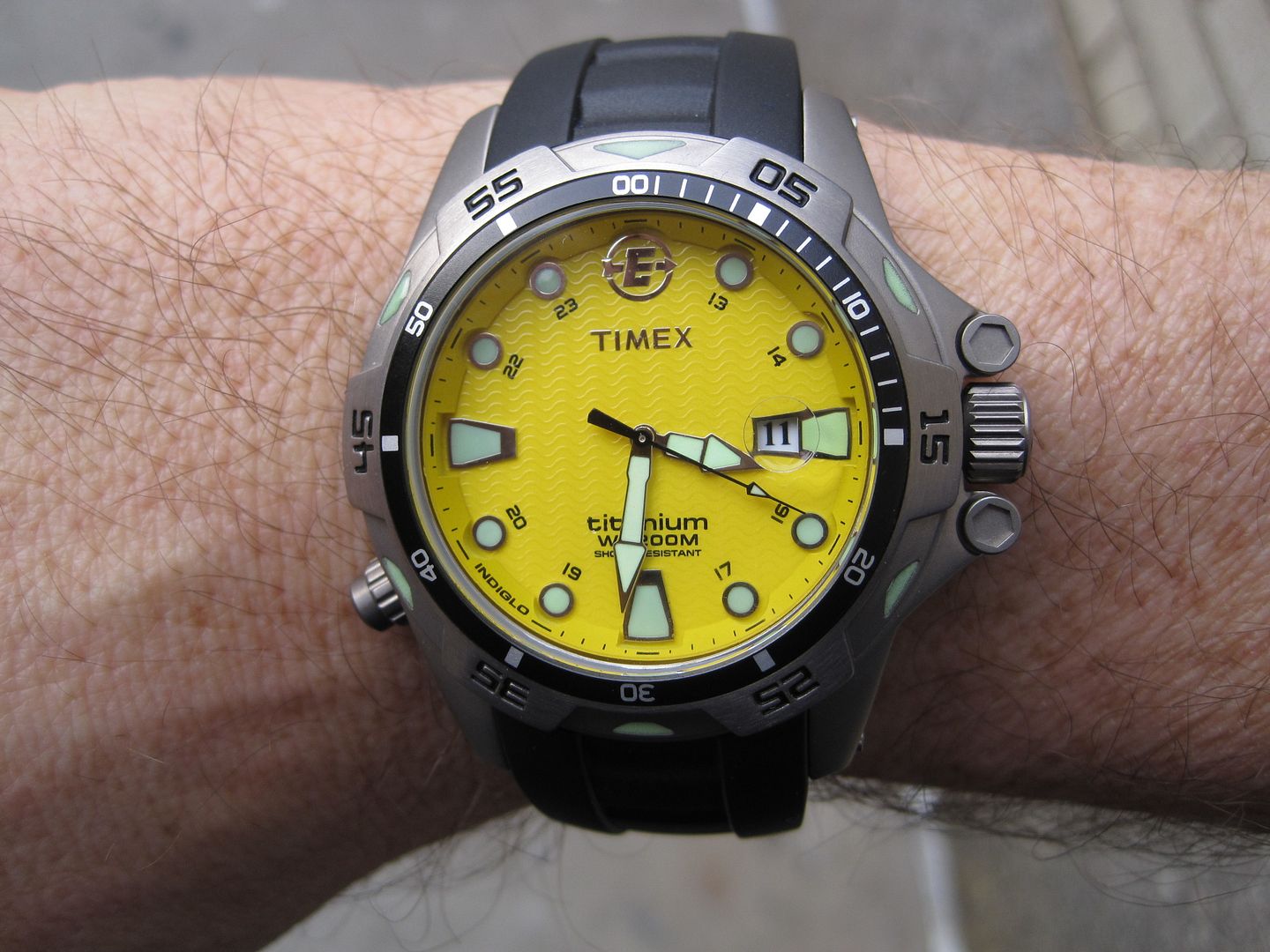 Timex T49617 & T49618 recommendations | WatchUSeek Watch Forums